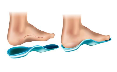 Comparing Full-Length and Partial-Length Orthotics | Austin Foot and ...